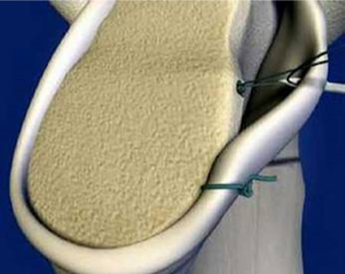 Shoulder Instability Injury - A+ Orthopaedics & Sports Med Center